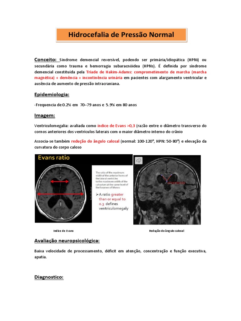 Hidrocefalia de Pressão Normal (HPN) | PDF