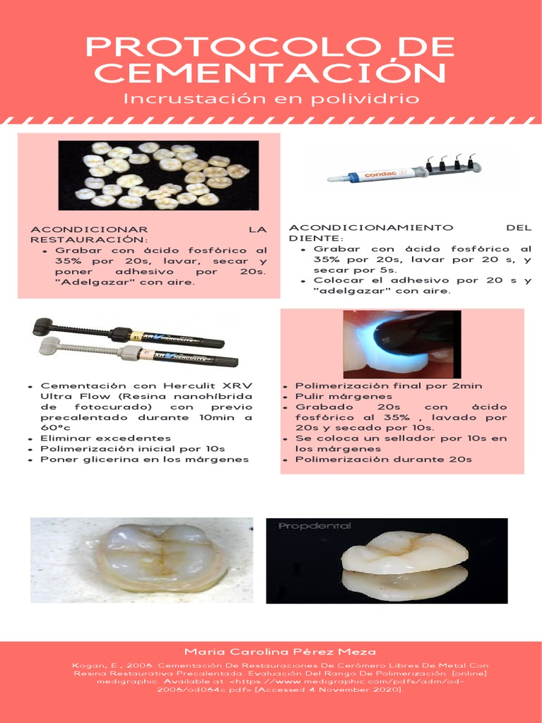 Cementacion Polividrio | PDF