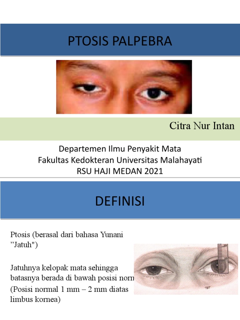 Citra Mata | PDF | Sains & Matematika