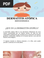 Dermatitis Atopica GPC | PDF | Alergia | Inmunología