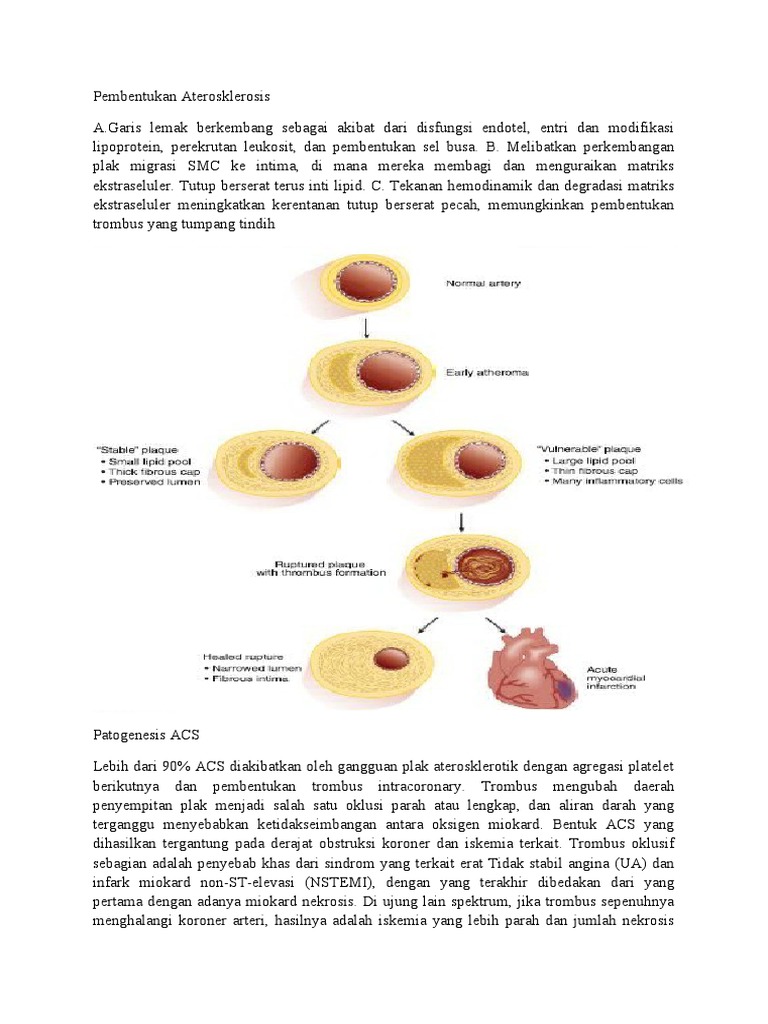 Aterosklerosis dan ACS: Patogenesis | PDF