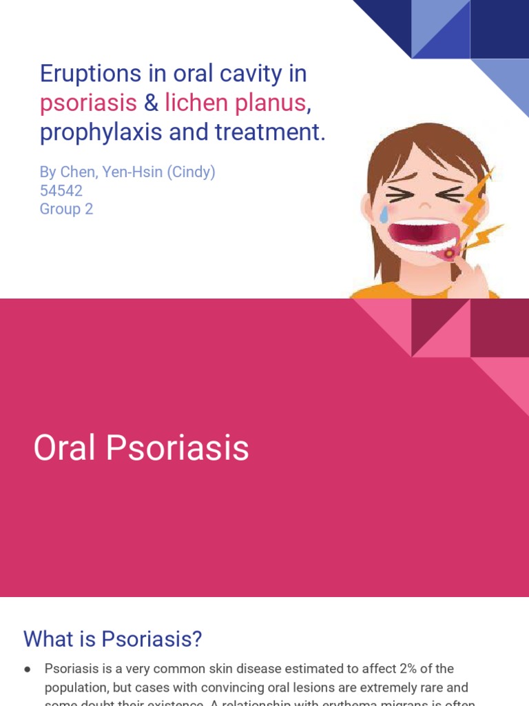 Eruptions in Oral Cavity in &, Prophylaxis and Treatment.: Psoriasis ...