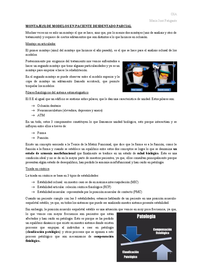 Montaje de Modelos en Desdentados Parciales | PDF | Dentadura postiza ...