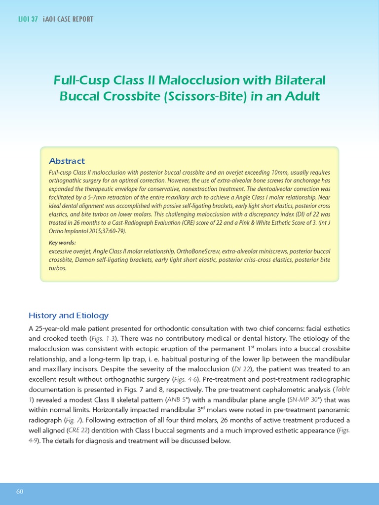 2 Full-Cusp Class II Malocclusion With Bilateral | PDF | Dentistry ...