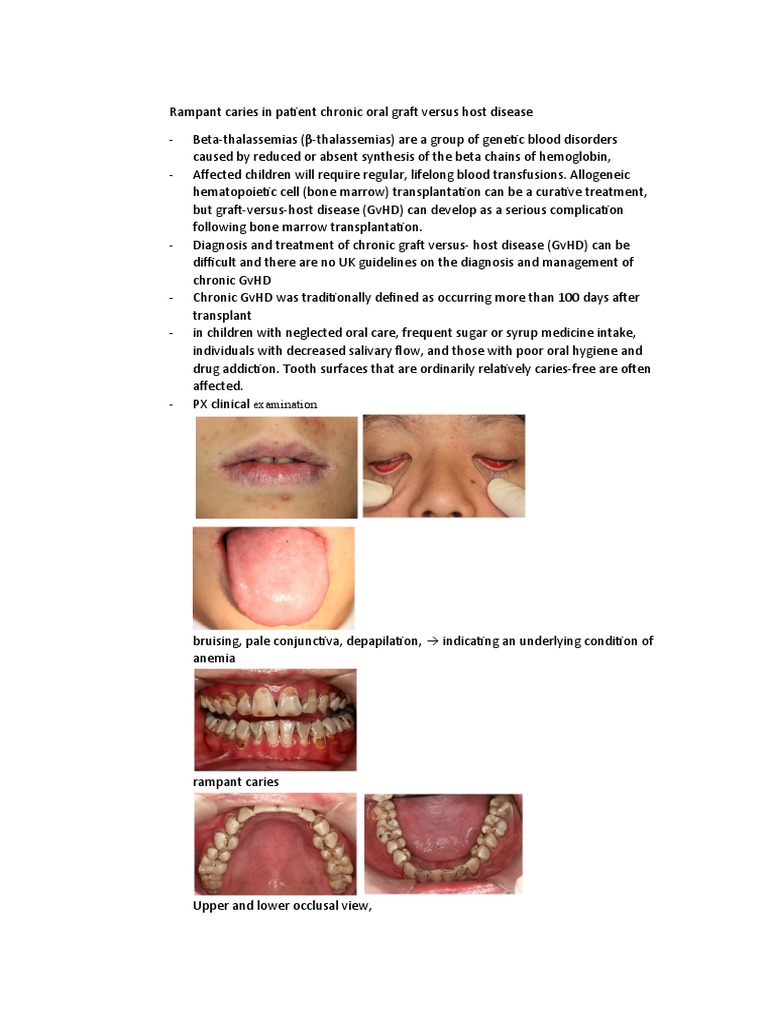 Rampant Caries | PDF | Oral Hygiene | Hematopoietic Stem Cell ...