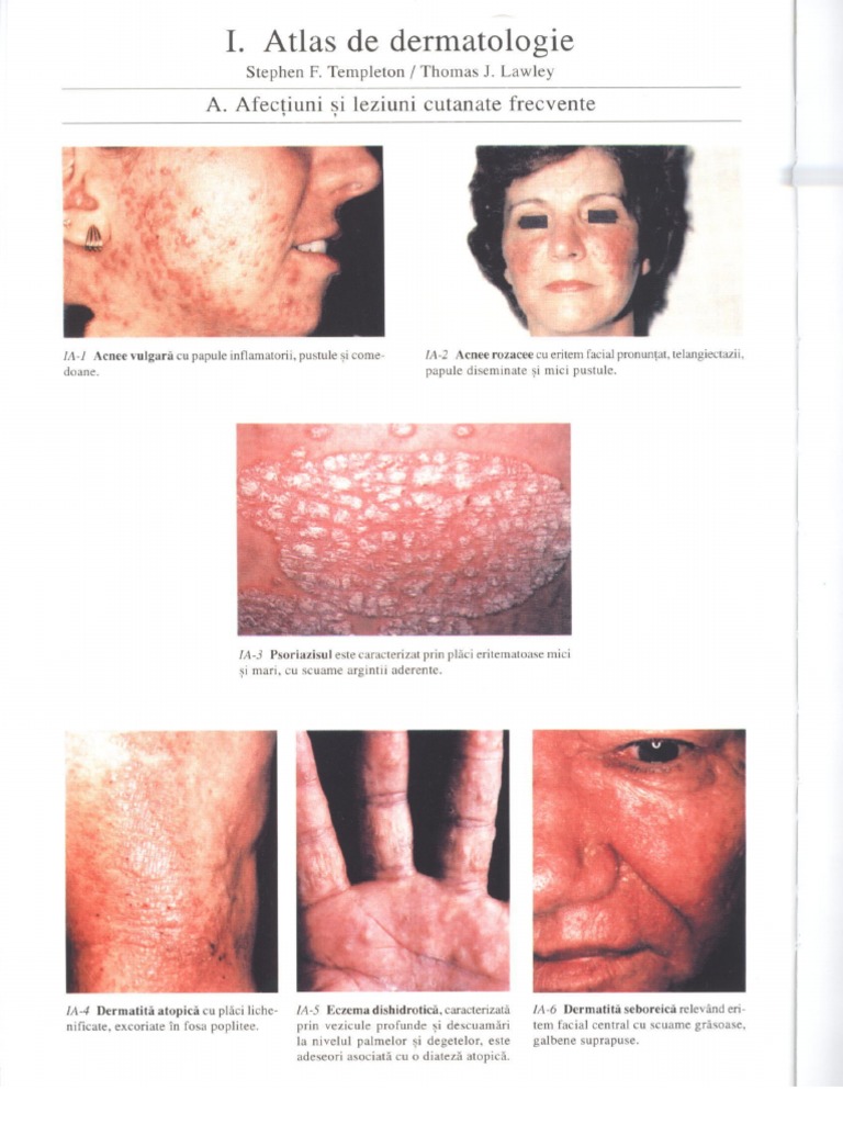 Atlas de Dermatologie | PDF