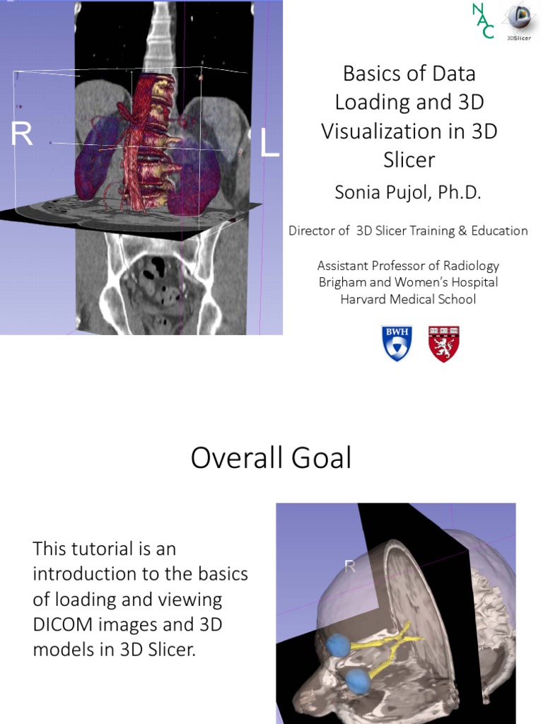 Basics of Data Loading and 3D Visualization in 3D Slicer: Sonia Pujol, PH.D | PDF | 3 D Computer ...