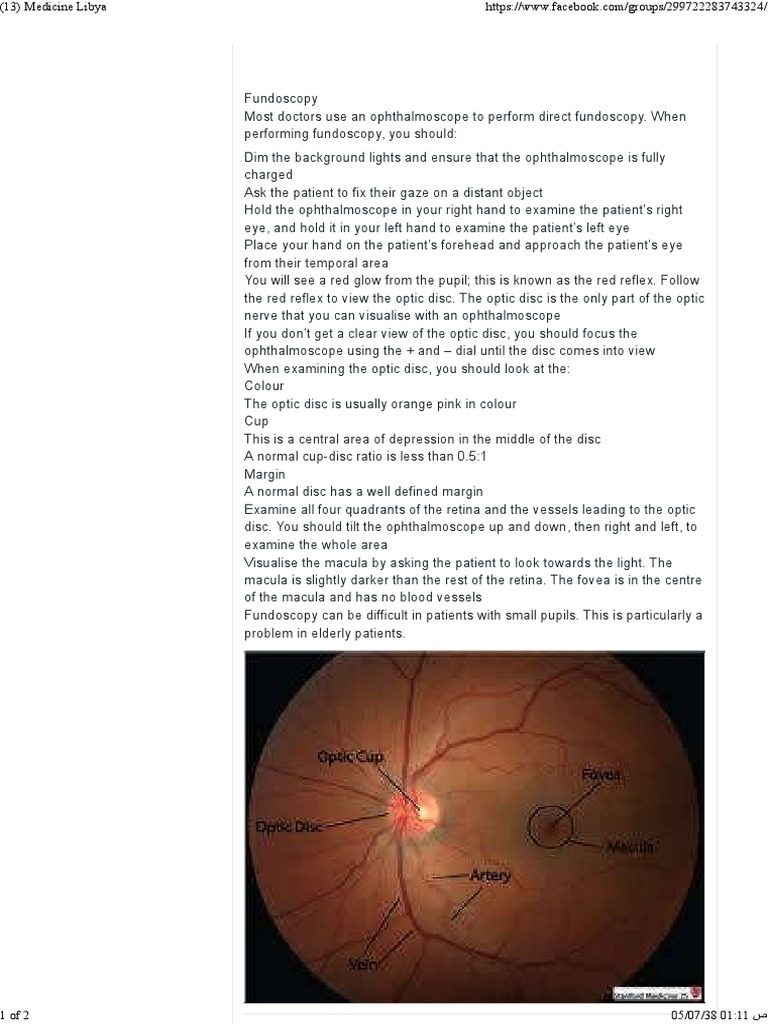 Ophthalmology Pictures For MRCP Part-2 Written | PDF | Visual System ...