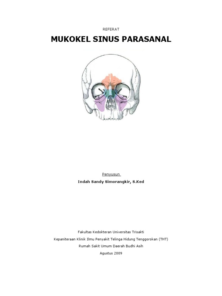 Mukokel Sinus Paranasal | PDF