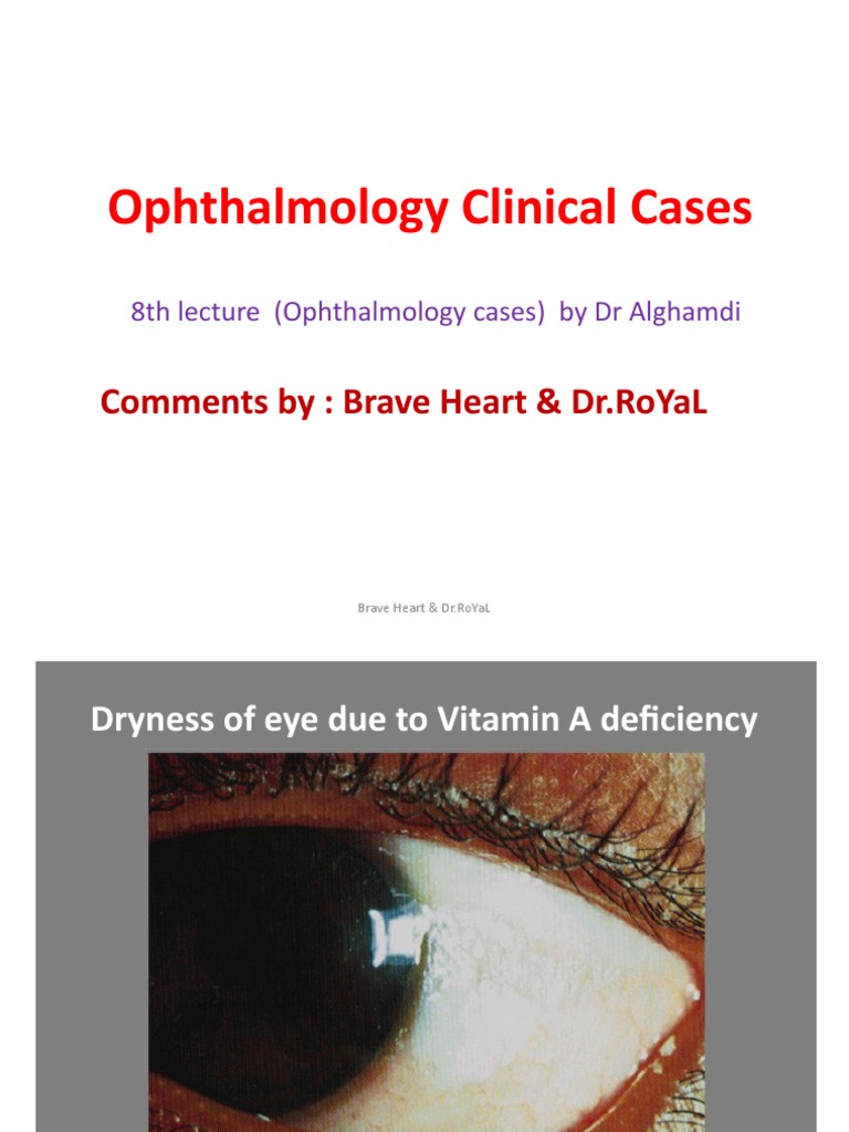 Ophthalmology Clinical Cases pixOpOp | PDF | Cornea | Diseases Of The ...