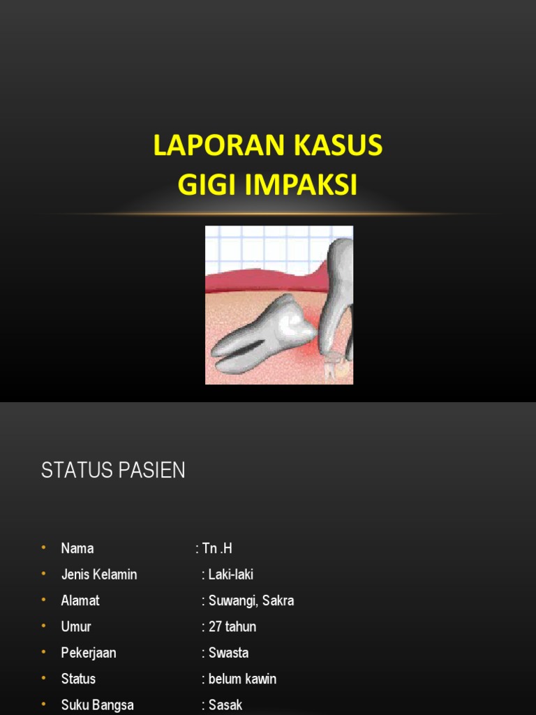Impaksi | PDF