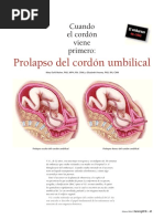 DISTOCIAS DE CORDON UMBILICAL | PDF | Placenta | Feto