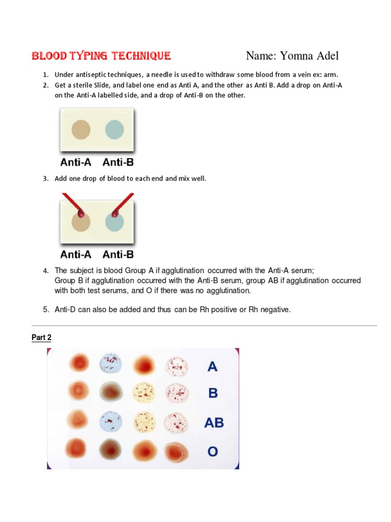 Blood Typing Technique | PDF