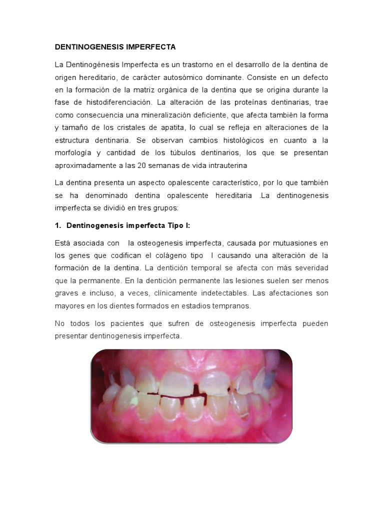 Dentinogenesis Imperfecta | PDF | Diente | Dentina