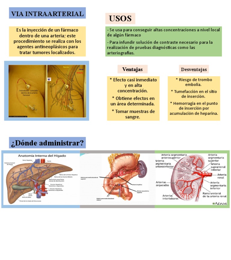 Via Intraarterial | PDF