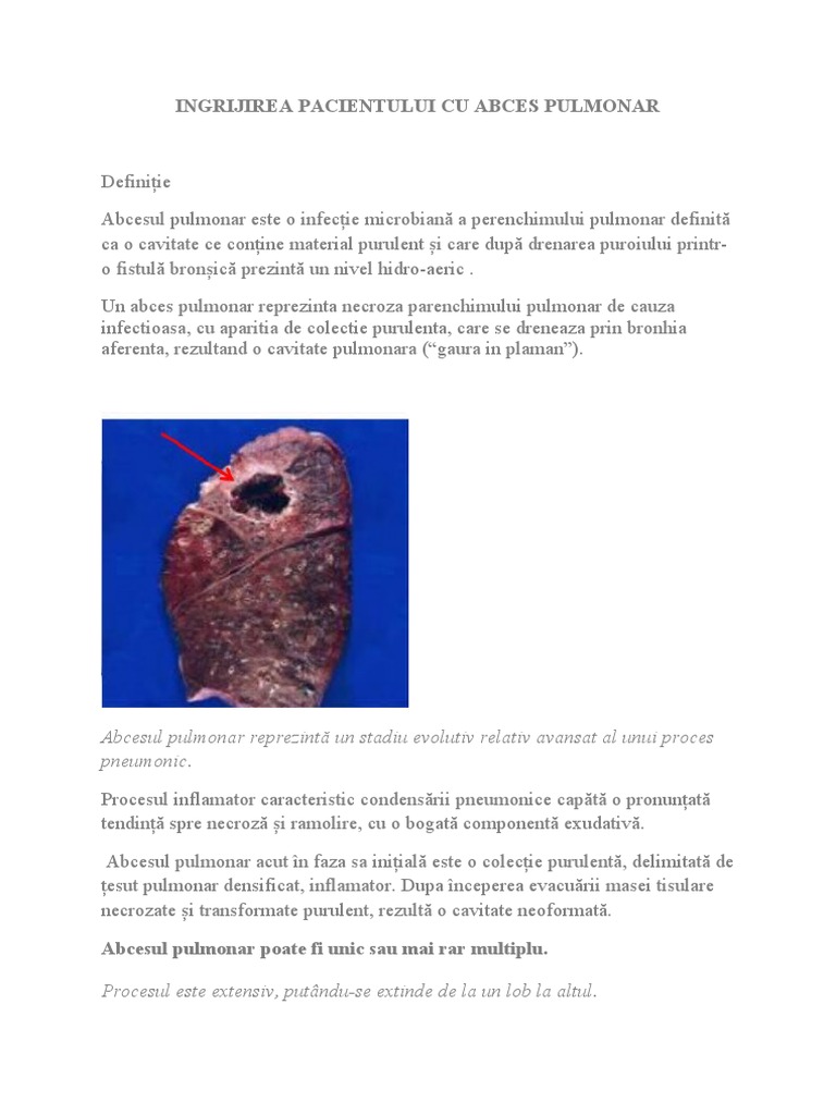 Abces Pulmonar | PDF