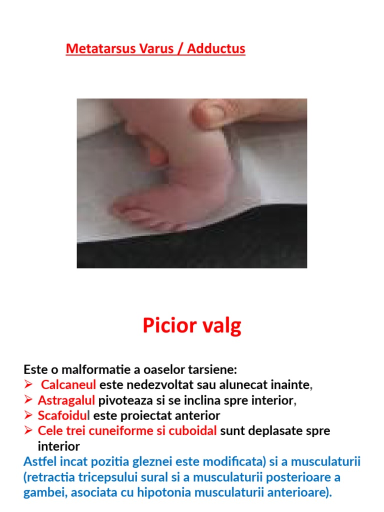 Picior Var | PDF