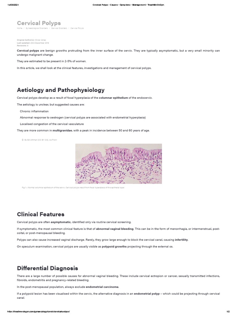 Cervical Polyps - Causes - Symptoms - Management - TeachMeObGyn | PDF ...