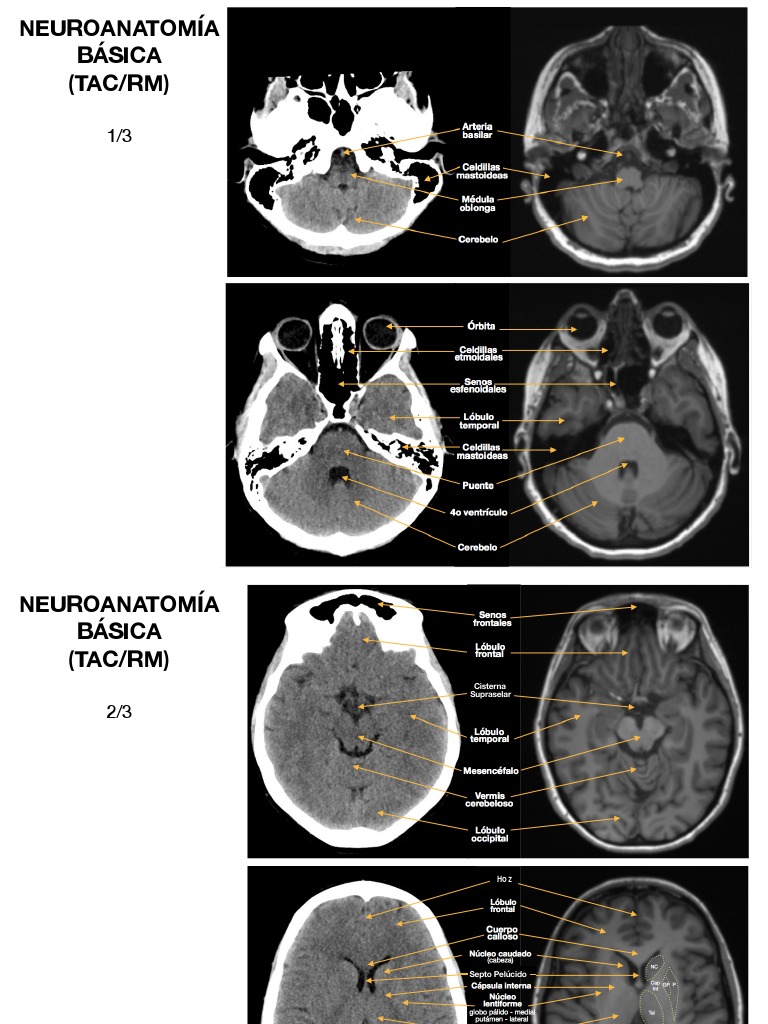 Neuroanatomía Básica | PDF