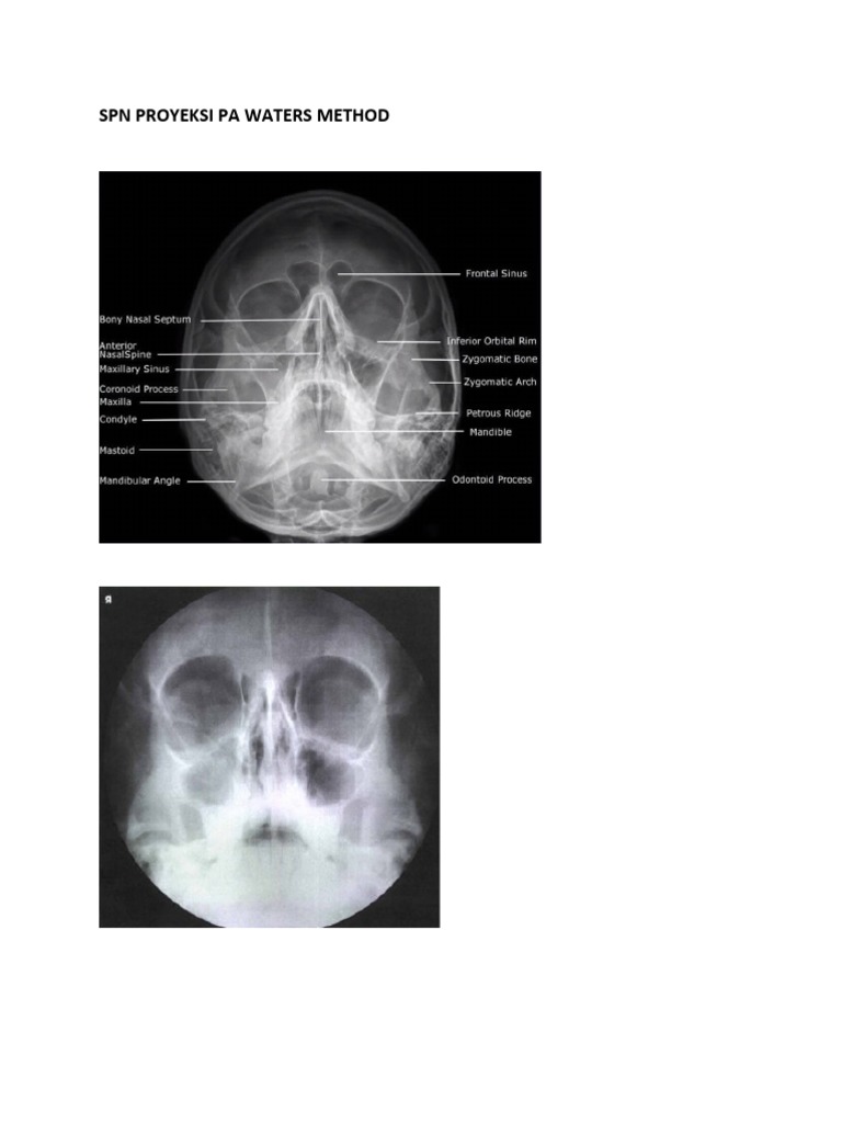 SPN Proyeksi Pa Waters Method | PDF