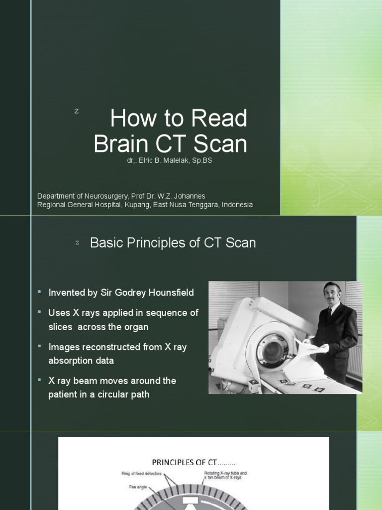 How To Read Brain CT Scan | PDF | Traumatic Brain Injury | Nervous System