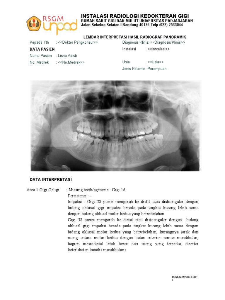 Radiografi Panoramik | PDF