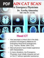 How To Read A Head CT Scan | PDF | Ct Scan | Neurology
