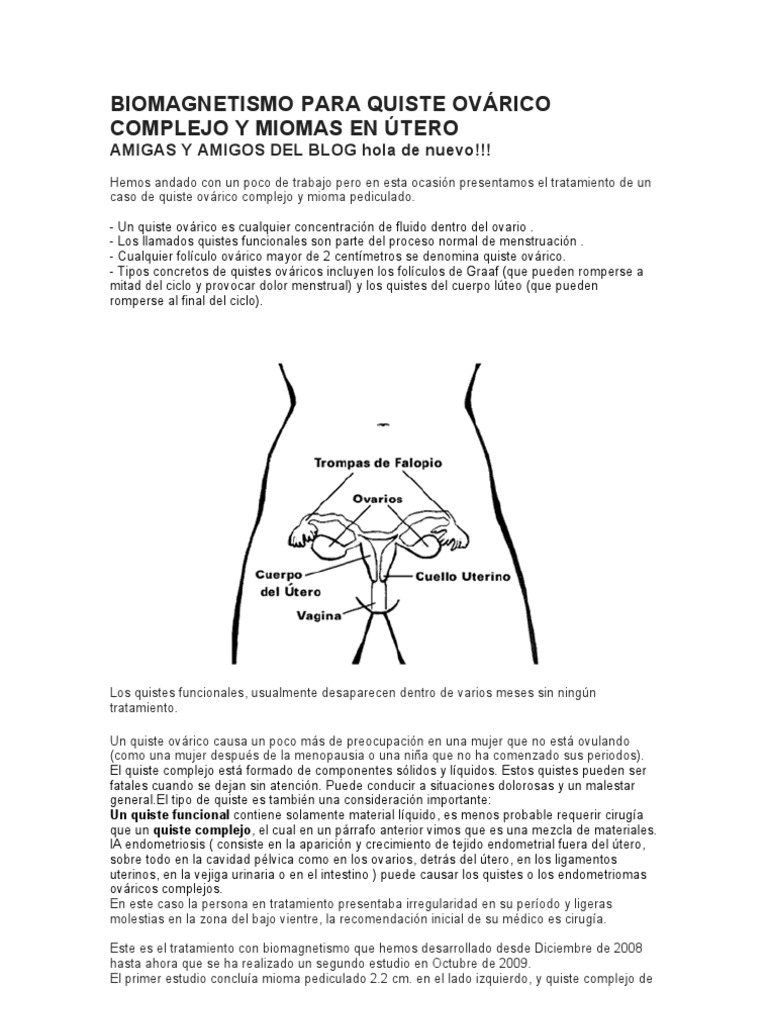 Biomagnetismo para Quiste Ovárico Complejo y Miomas en Útero | PDF ...