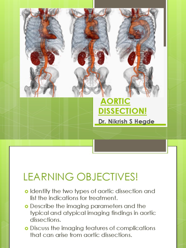 Aortic Dissection!: Dr. Nikrish S Hegde | PDF | Aorta | Cardiovascular ...
