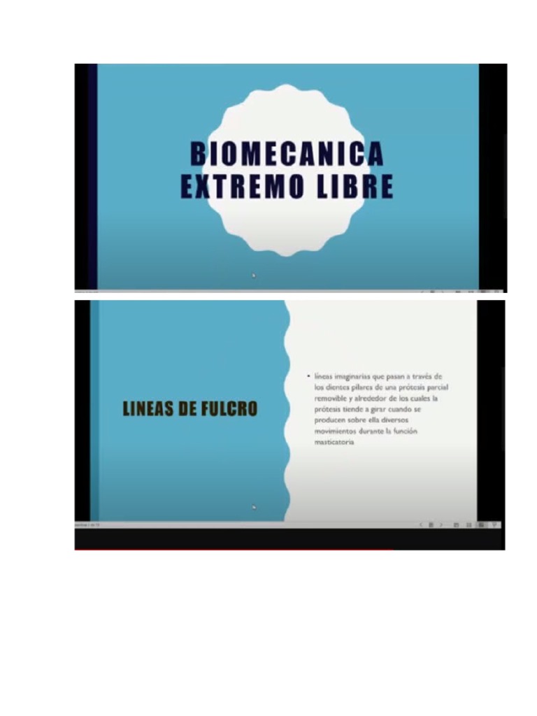 Rpi-Rpa Protesis | PDF