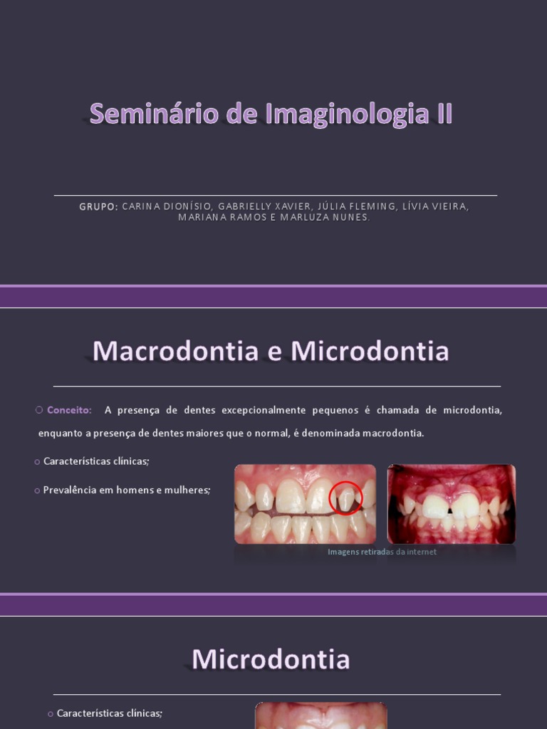 Macrodontia e Microdontia (SLIDE) | PDF | Dente | Odontologia