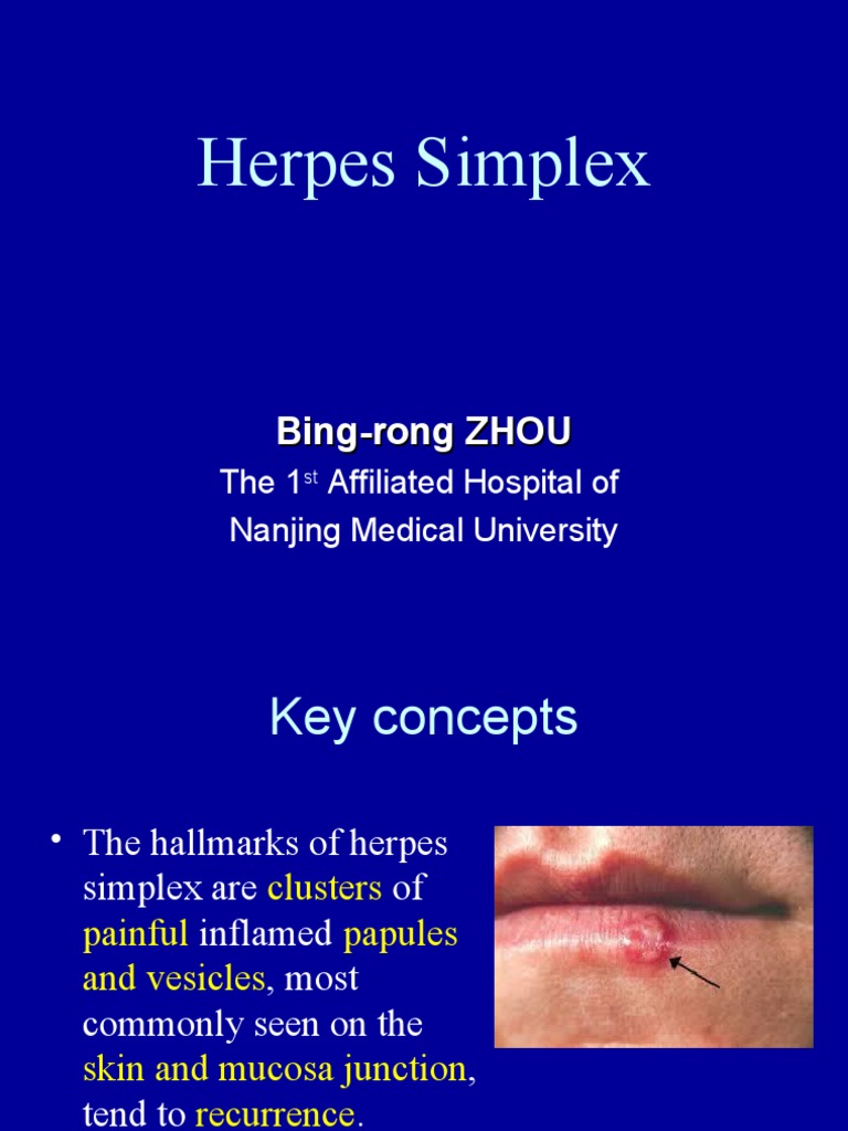 Herpes Simplex | PDF | Herpes Simplex | Diseases And Disorders