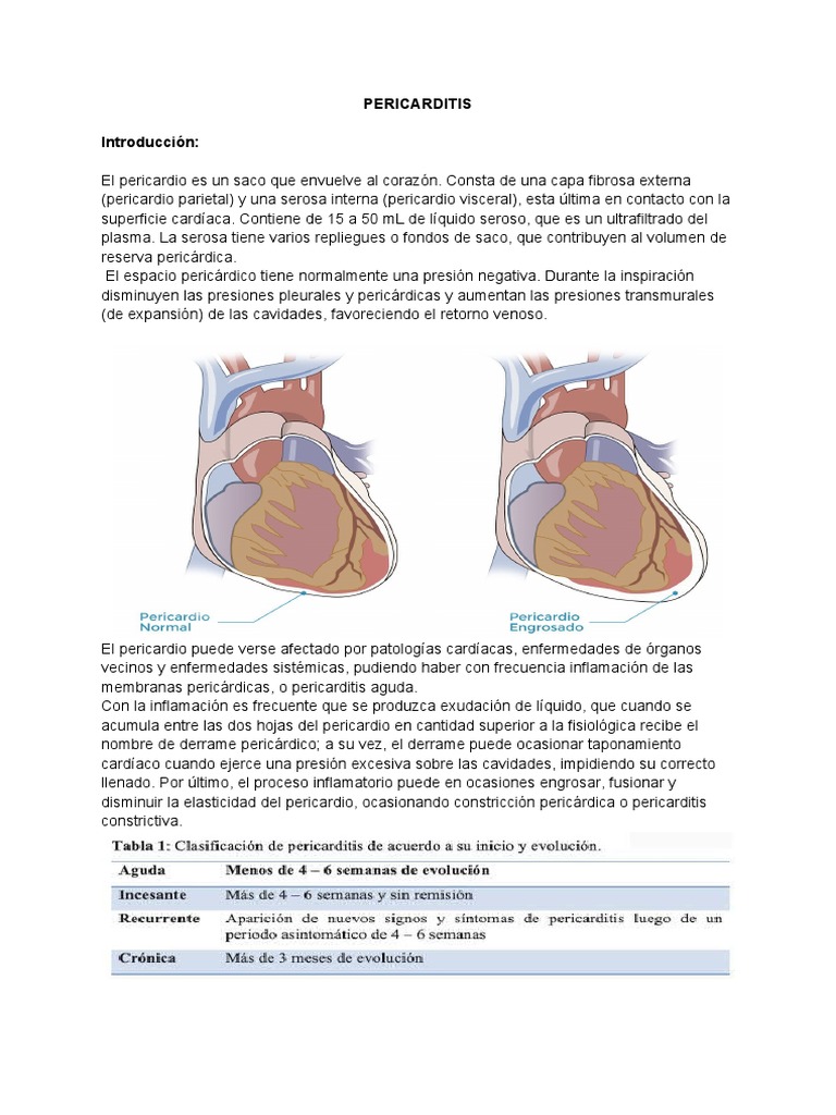 Pericarditis | PDF | Diagnostico medico | Insuficiencia cardíaca