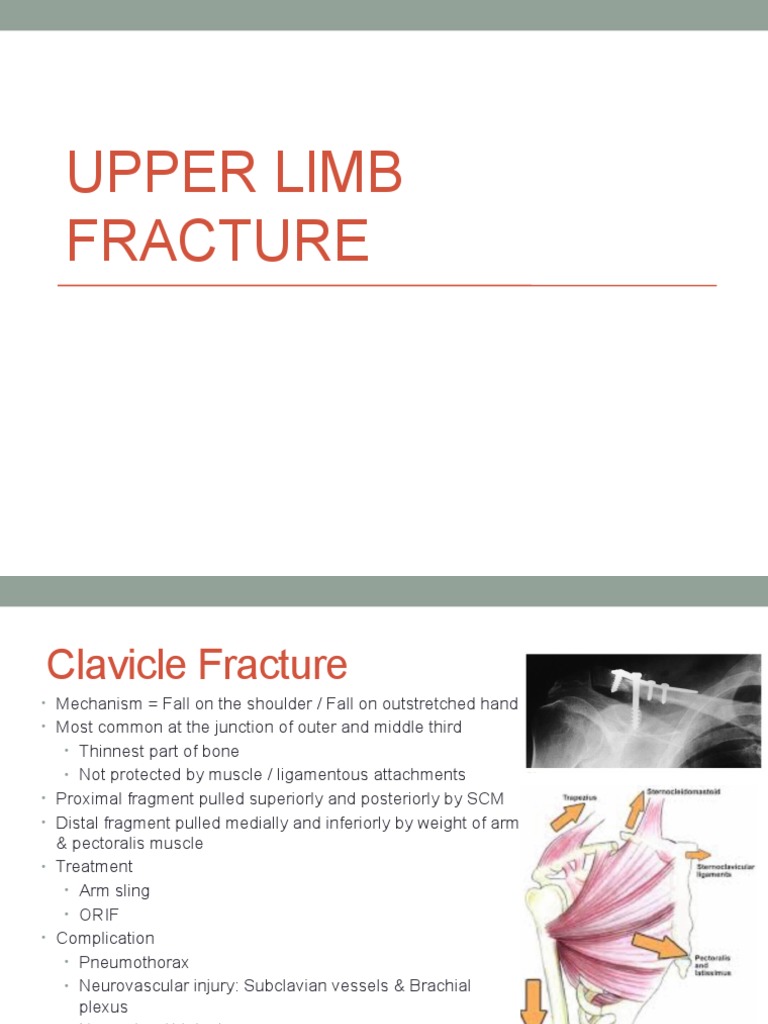 Upper Limb Fracture | PDF | Arm | Elbow
