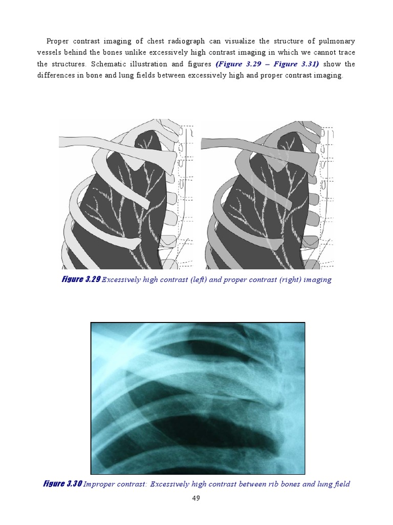 (Figure 3.29 - Figure 3.31) : Excessively High Contrast (Left) and ...