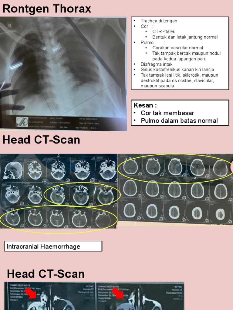 Laporan Hasil Radiologi | PDF