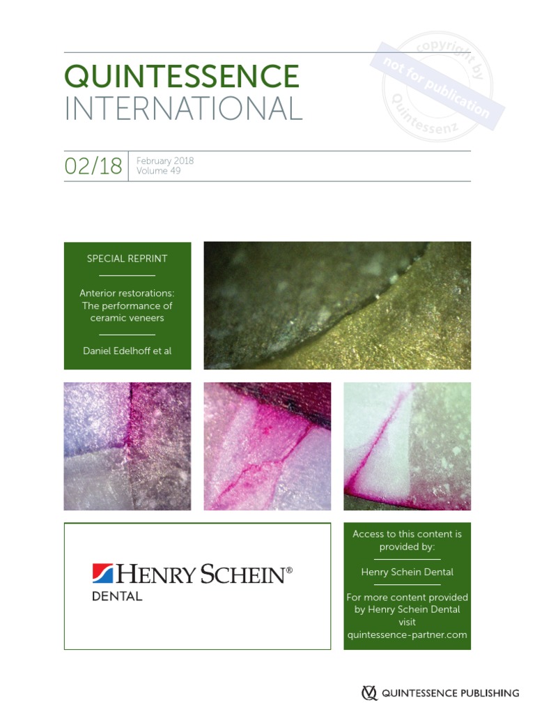 Edelhoff - Anterior Restorations: The Performance of Ceramic Veneers ...