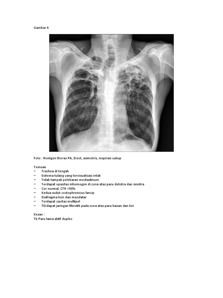 Radiologi | PDF