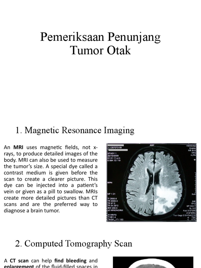 Pemeriksaan Penunjang Tumor Otak | PDF | Biopsy | Magnetic Resonance Imaging