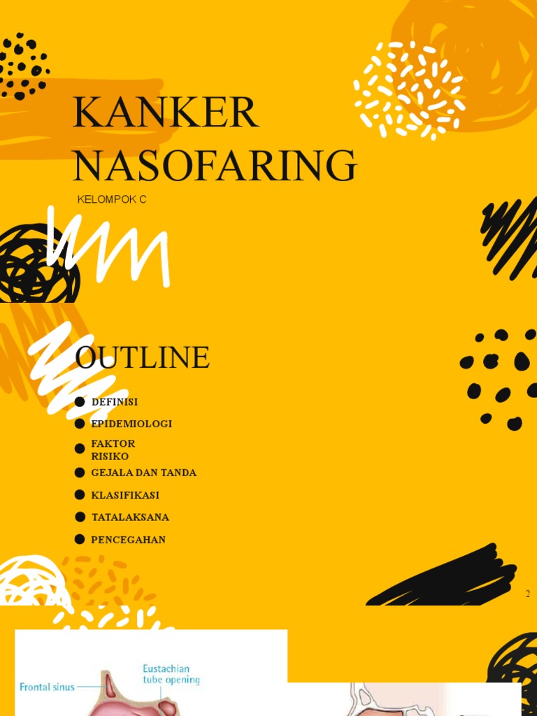 Kanker Nasofaring | PDF