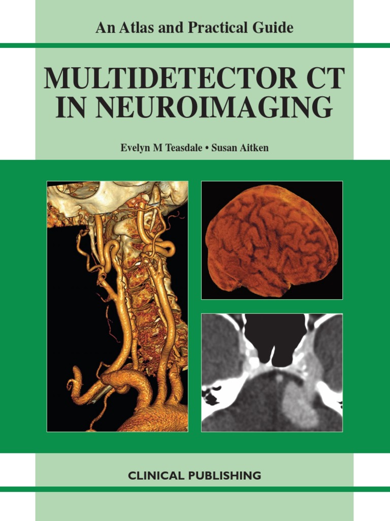 Atlas of Practical Guide Multidetector CT | PDF | Ct Scan | Medical Imaging