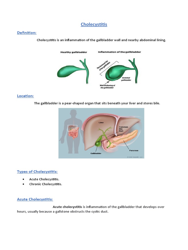 Cholecystitis: Definition | PDF