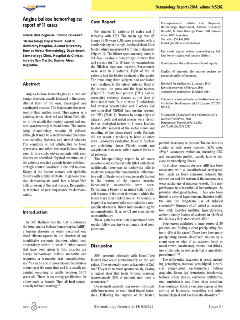 Angina Bullosa Hemorrhagica-Report of 11 Cases | PDF | Cutaneous ...