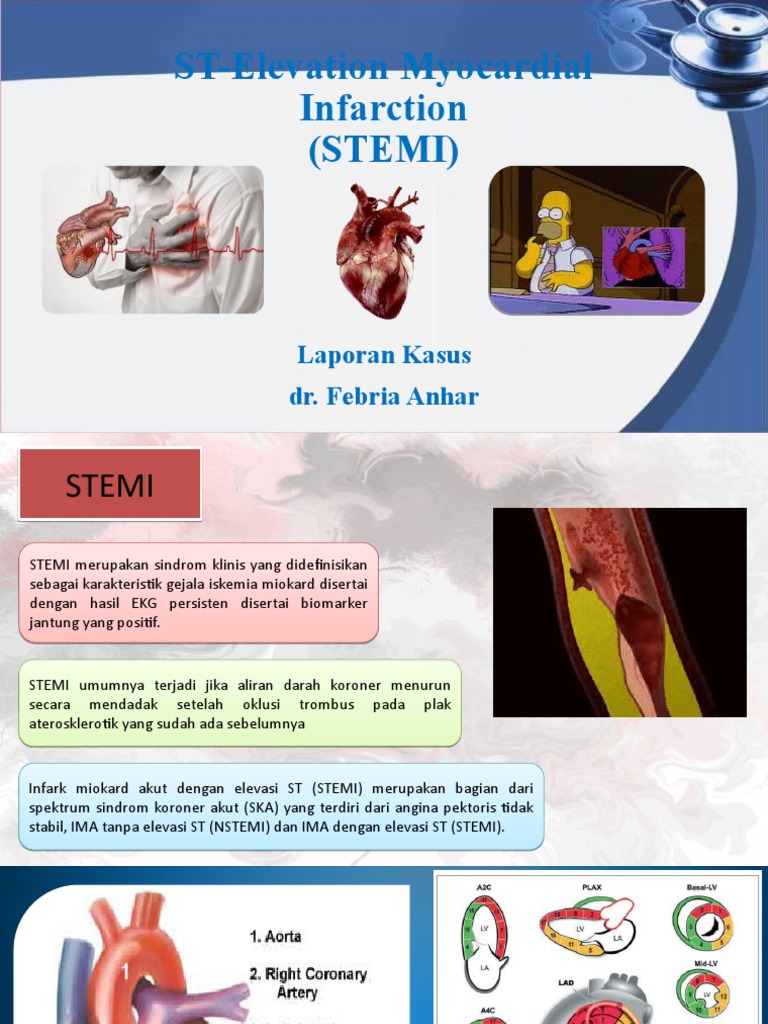 Penanganan dan Diagnosis STEMI | PDF