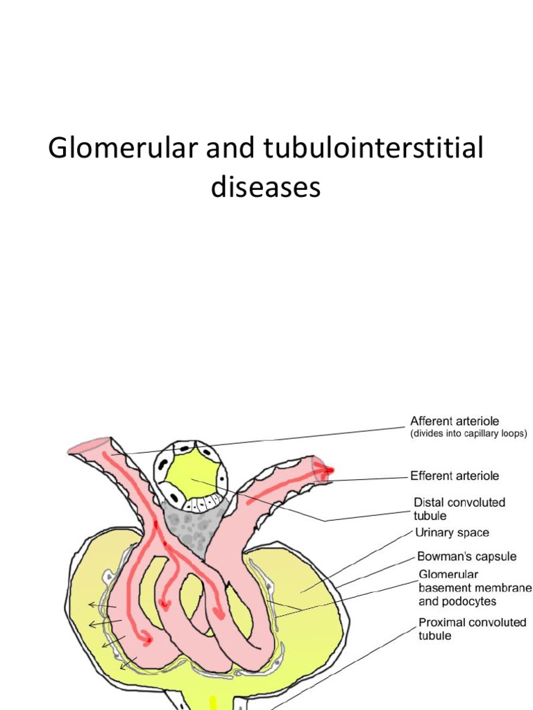 Glomerular Diseases | Download Free PDF | Kidney Disease | Nephrology