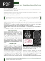 Cerebral Localization Parietal Lobe Signs | PDF | Parietal Lobe ...