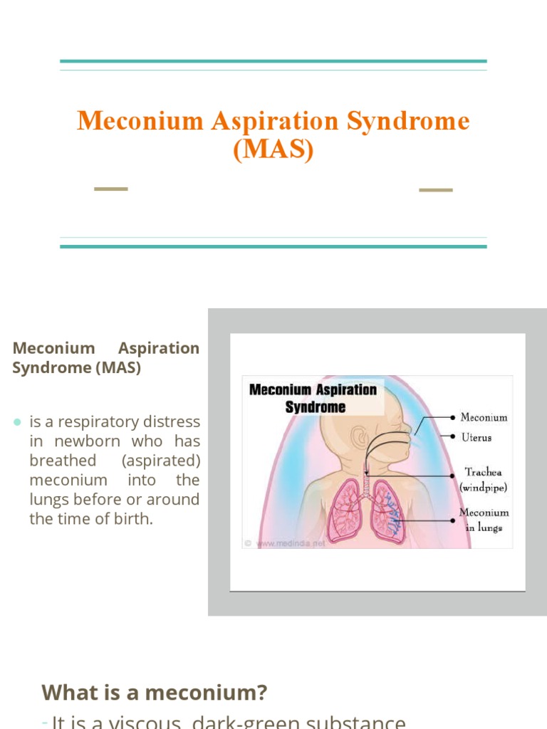 Meconium Aspiration Syndrome (MAS) | PDF | Respiration | Pulmonology