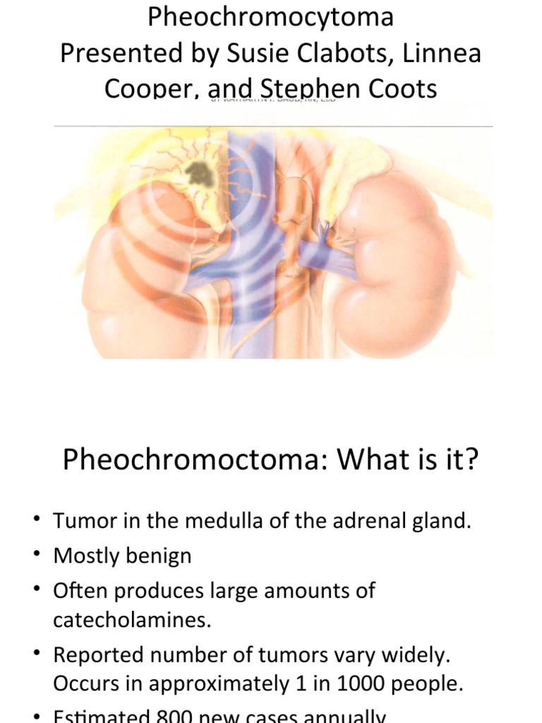 441 Pheochromo | PDF | Adrenal Gland | Cortisol