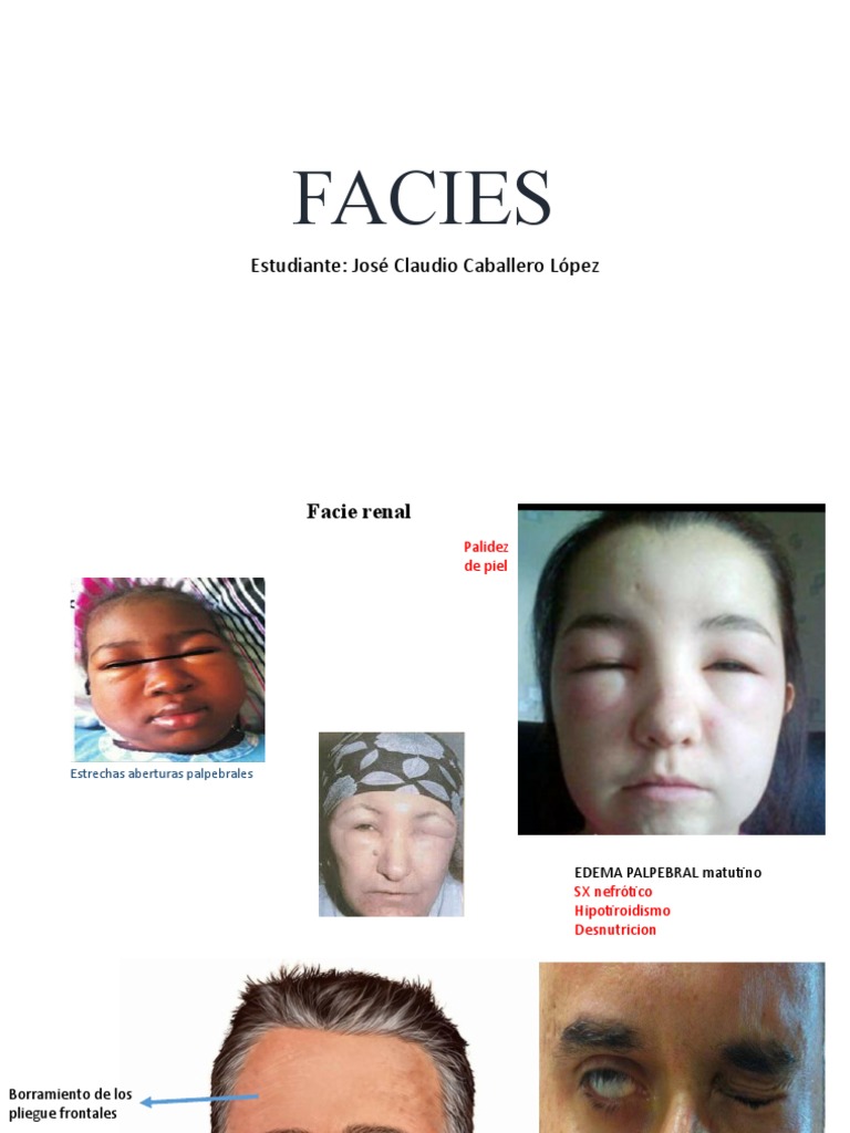 Facies Semiologia 2020 | PDF | Anatomía humana | Enfermedades y trastornos