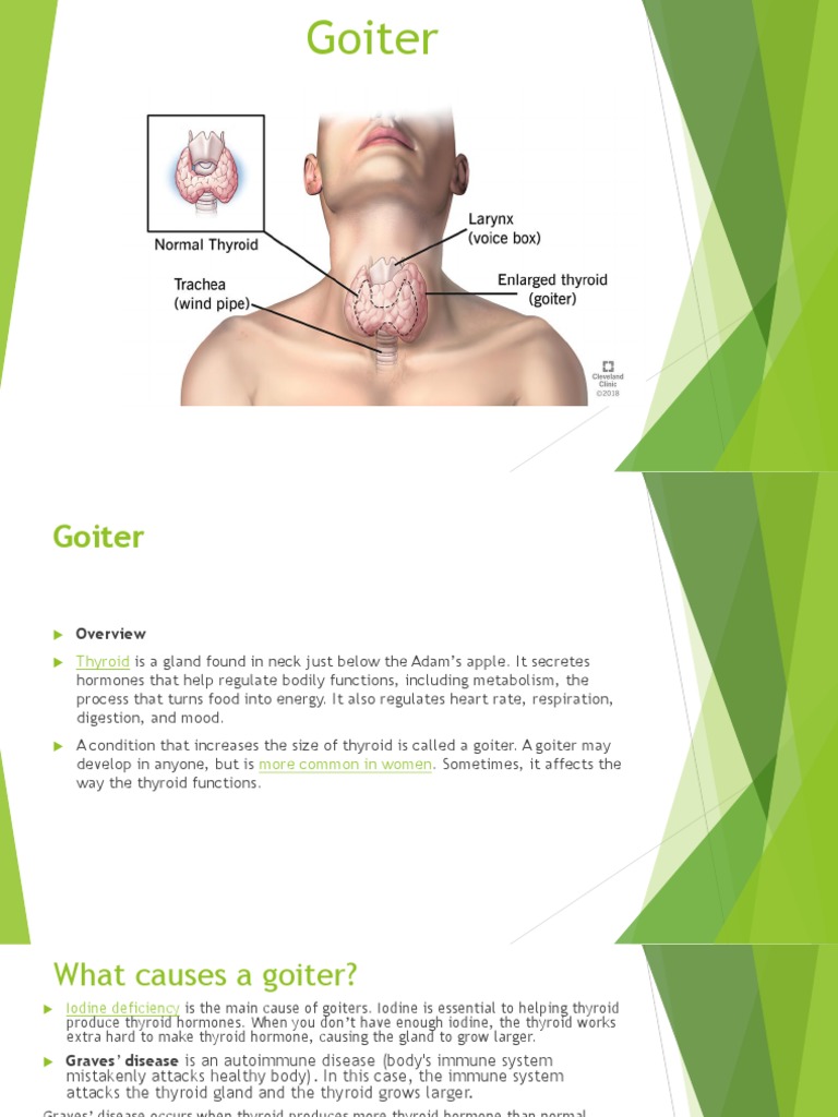 Endemic and Sporadic Goiter | Download Free PDF | Thyroid | Hyperthyroidism